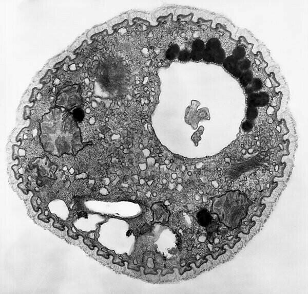 Vacuole Electron Micrograph